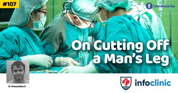 On cutting off a man’s leg | Infoclinic - The cure for ignorance is ...